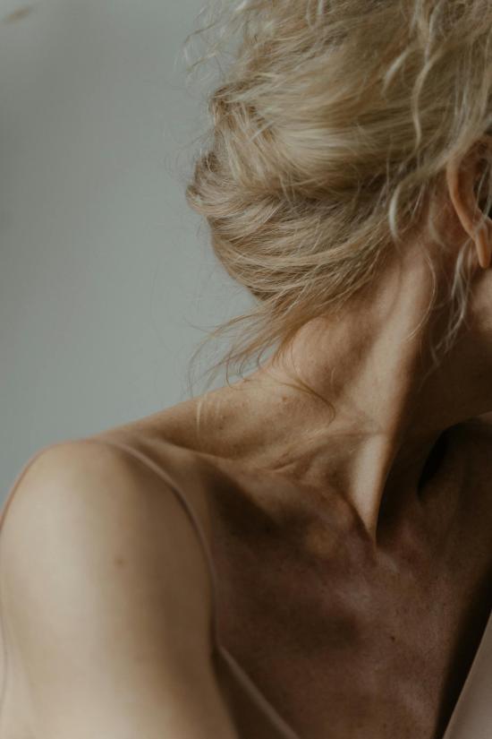 Check for Signs of Skin Cancer - Cancer Schmancer